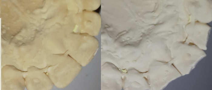 Ретенционная каппа своими руками | Пикабу